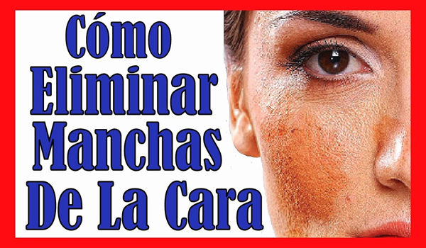 Recetas caseras para manchas en la piel